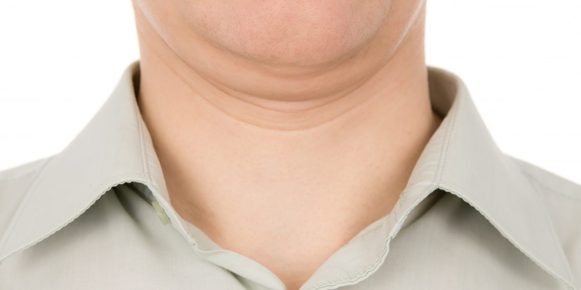 Four ways to lose that double chin - Healthifyme Blog